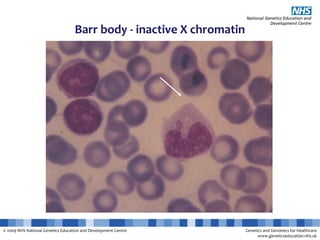 Explanation slides X Inactivation | PPT