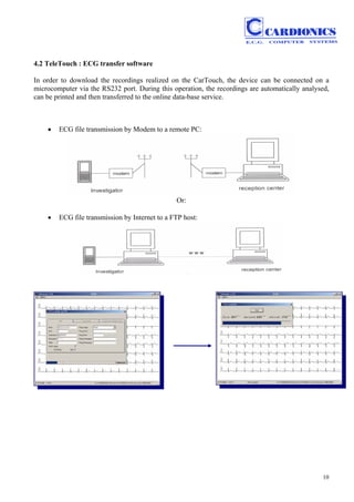 Cardionics Belgium ECG systems for CRO | PDF