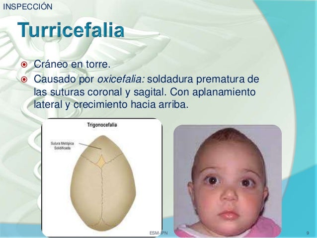 Exploración de craneo y cara