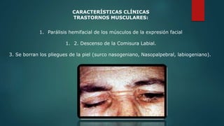 EXPLORACIÓN DEL NERVIO FACIAL VII.pptx