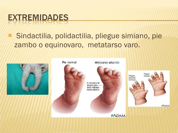 Exploración del recién nacido