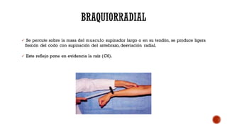 EXPLORACIÓN DE REFLEJOS. EXPO.pdf