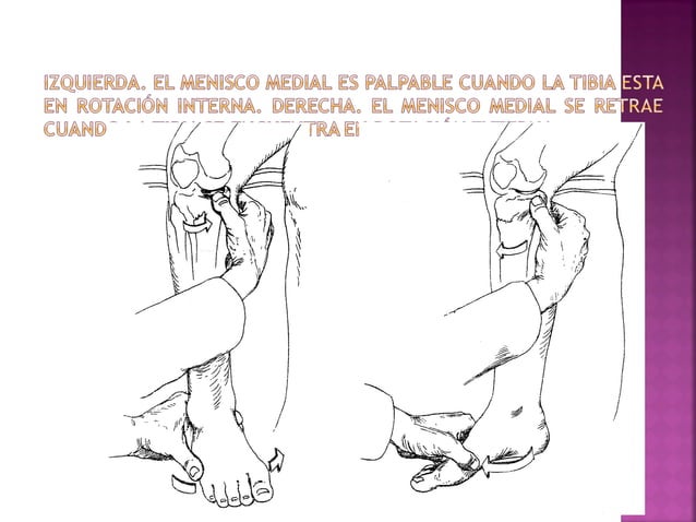 Exploración de rodilla | PPT