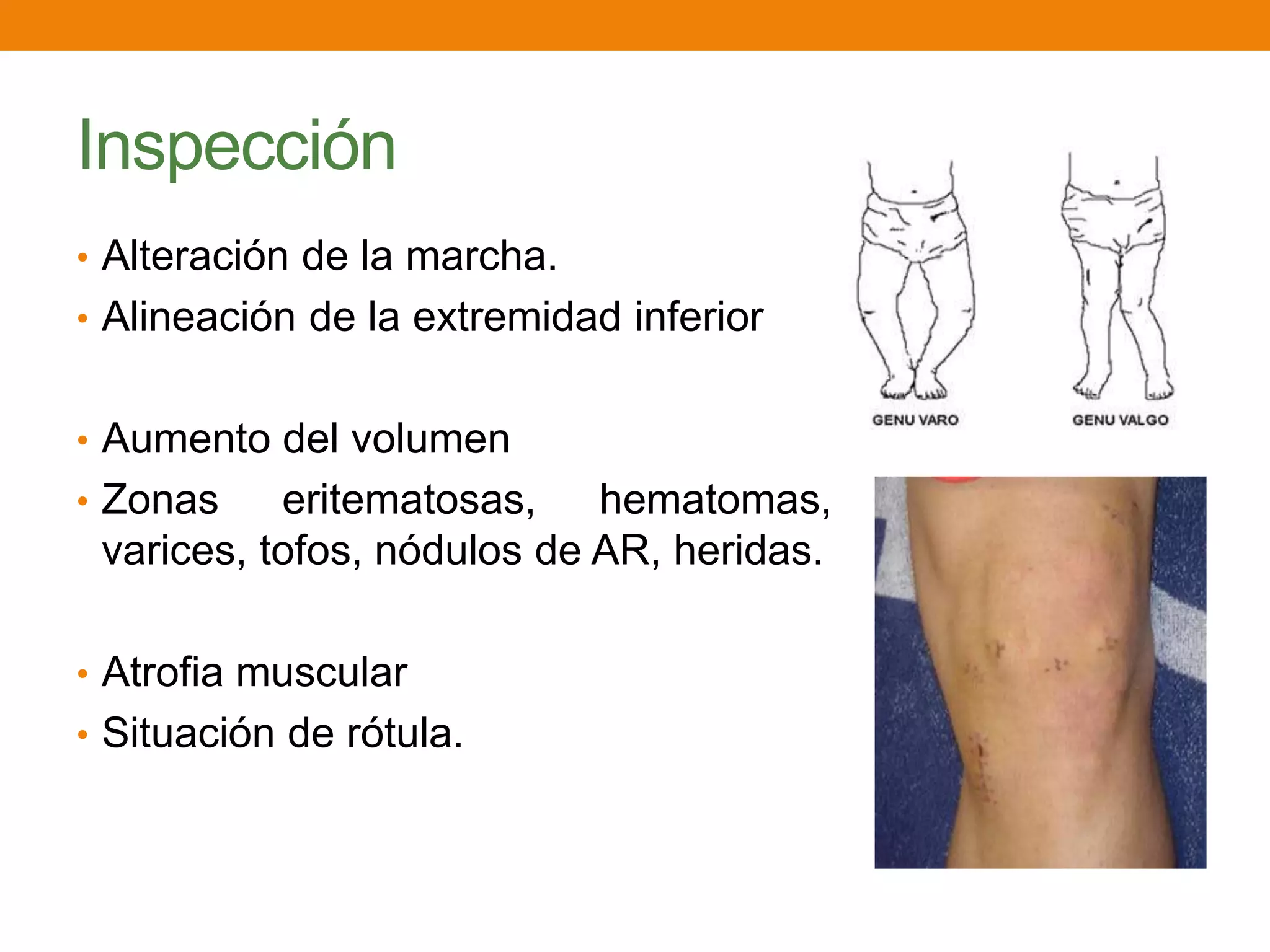 Exploración de rodilla | PPTX