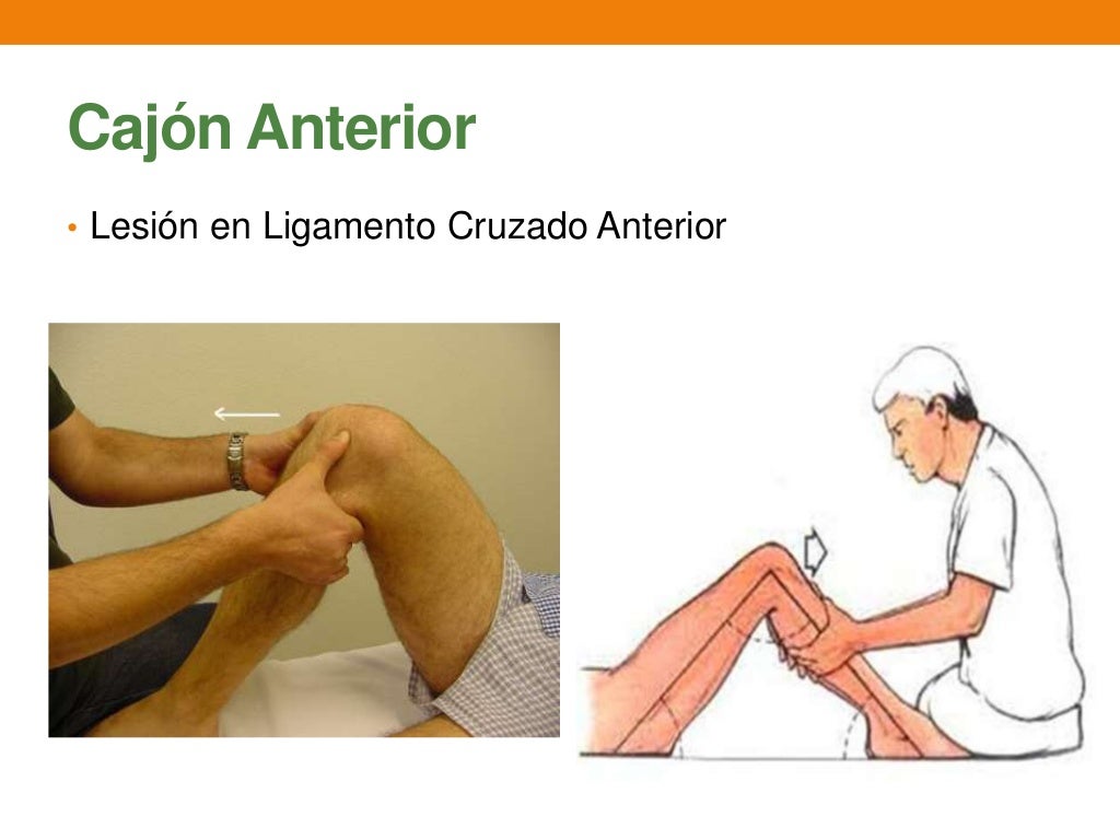 Exploración de rodilla