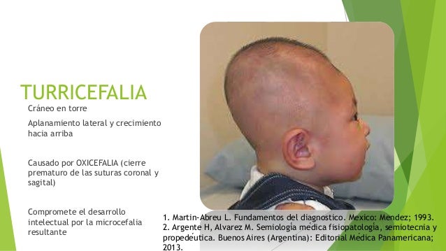 Exploración física cabeza