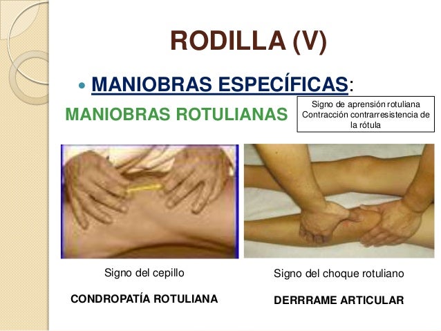 Exploración física en reumatología