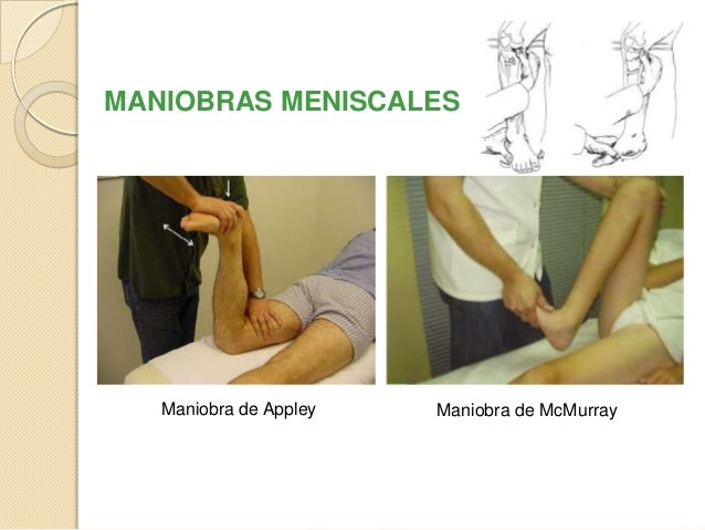 Exploración física en reumatología