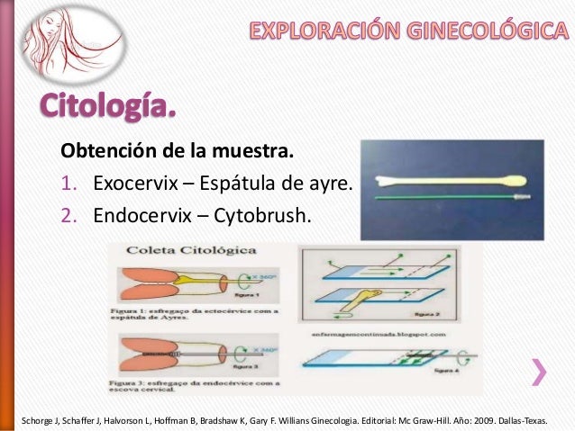 Exploración ginecológica , examen fisico ginecologico