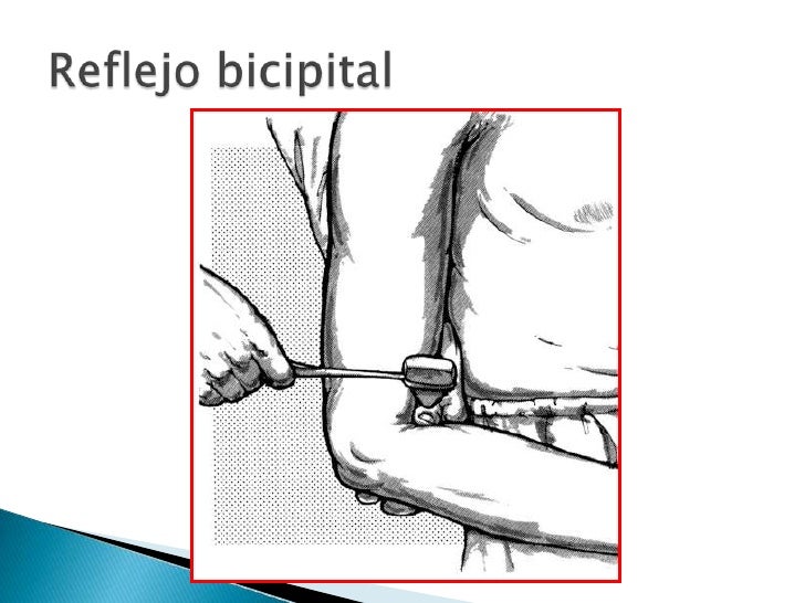 Exploración neurológica