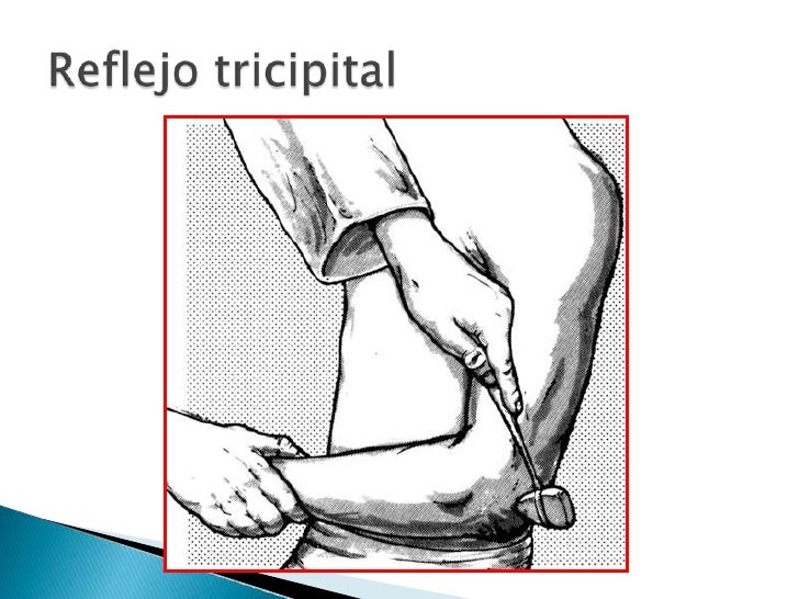 Exploración neurológica
