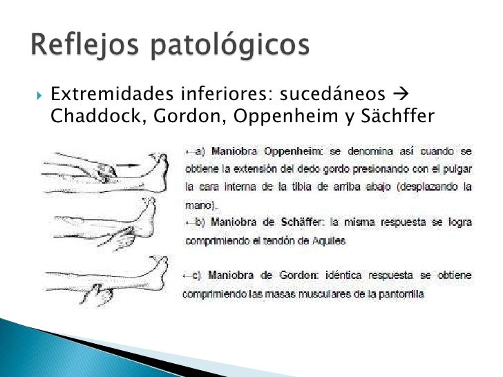 Exploración neurológica