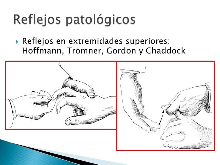 Exploración neurológica