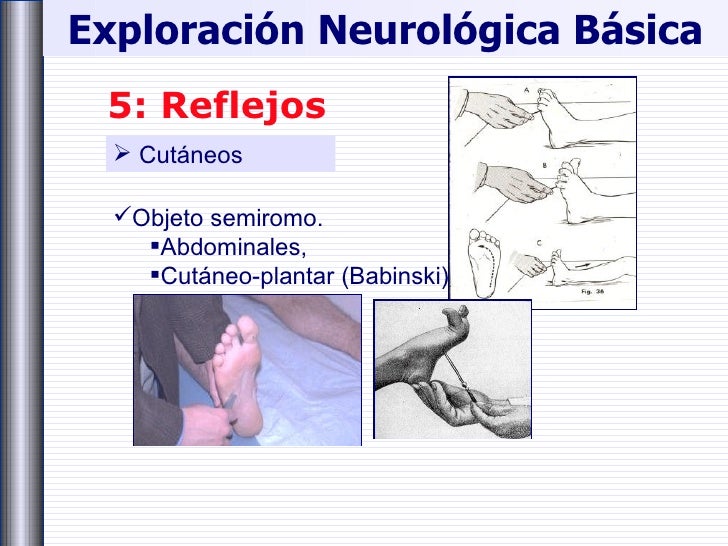 Exploración neurologica básica