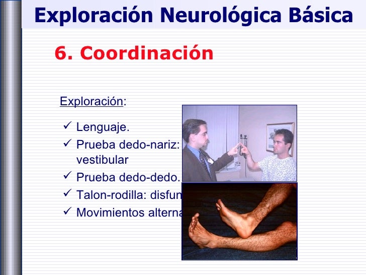 Exploración neurologica básica