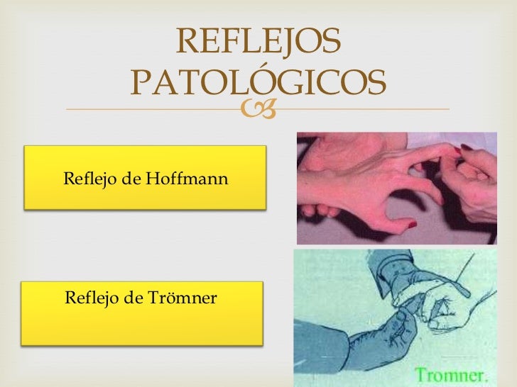 Exploración neuropsiquiátrica