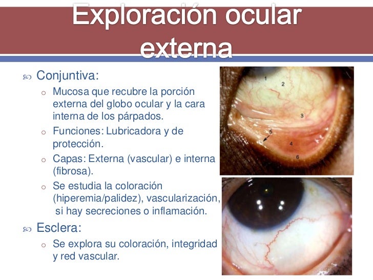 Exploración oftalmológica