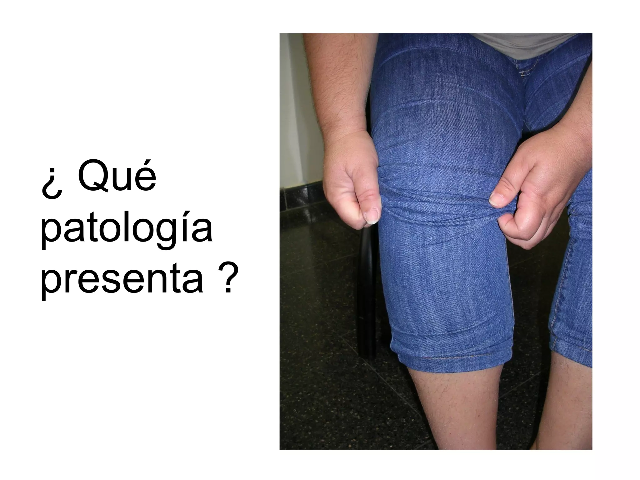 Exploración rodilla (versión reducida.hospital) | PPT