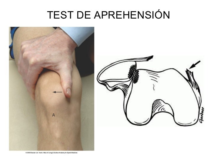 Exploración rodilla (versión reducida.hospital)