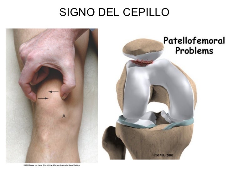 Exploración rodilla (versión reducida.hospital)