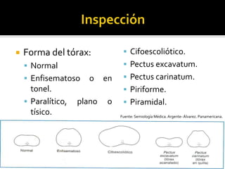 Exploración Respiratoria Normal | PPTX