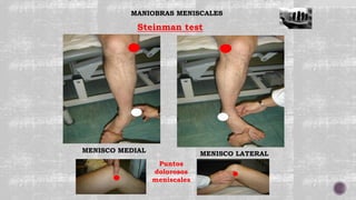 Exploración básica en traumatología: curiosidades y truquillos | PDF