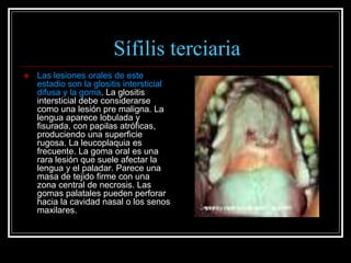 Exploración clínica de la cavidad oral.ppt