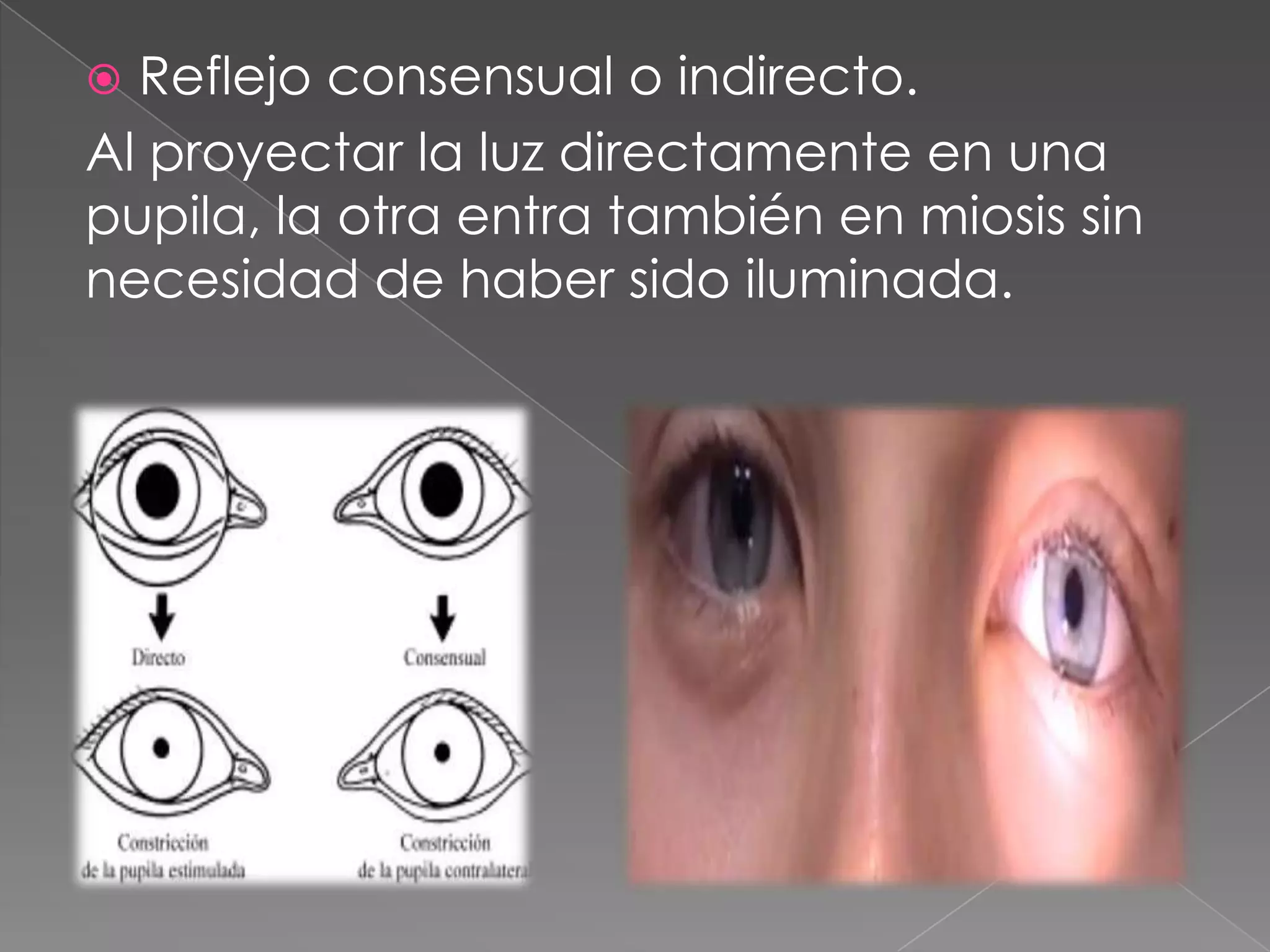 Exploracion de los reflejos pupilares