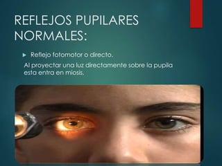 Exploracion de pupilas | PPTX
