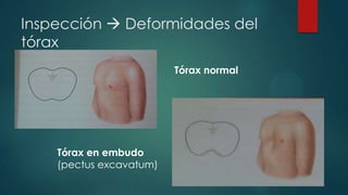 Exploracion de torax | PPTX