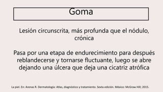 Exploración Física De La Piel y Lesiones Cutáneas Elementales | PPTX