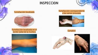 EXPLORACION FISICA DEL MIEMBRO SUPERIOR (2) (1).pdf