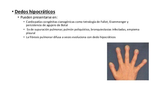 Exploración física neumológica