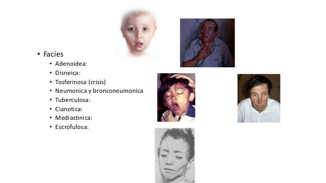 Exploración física neumológica