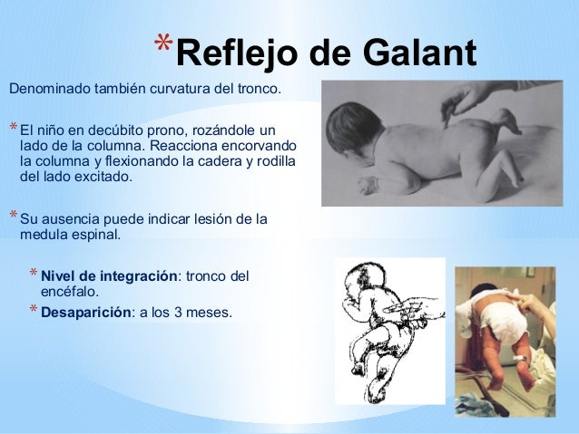 Exploracion Neurologica Pediatrica