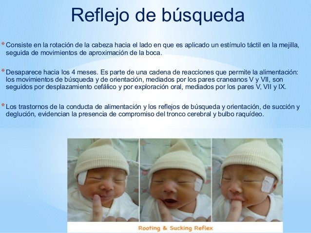 Exploracion Neurologica Pediatrica