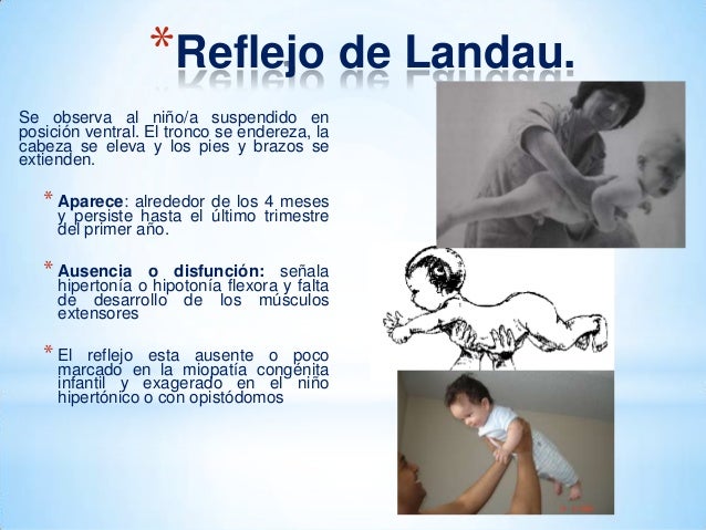 Exploracion neurologica pediatrica version 15