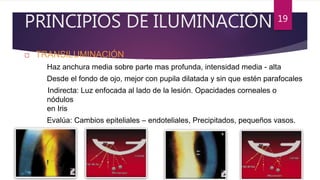 Exploracion ocular | PPTX