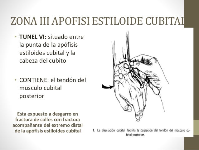 Exploracion ortopedica