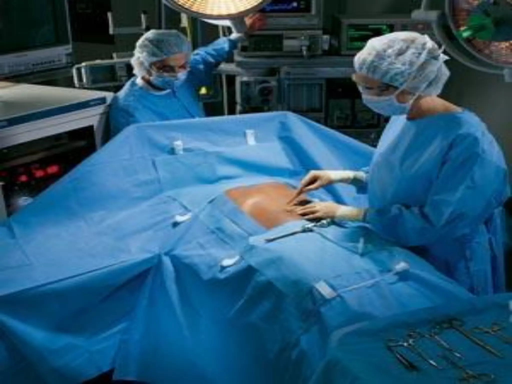 Exploratory laparotomy | PDF