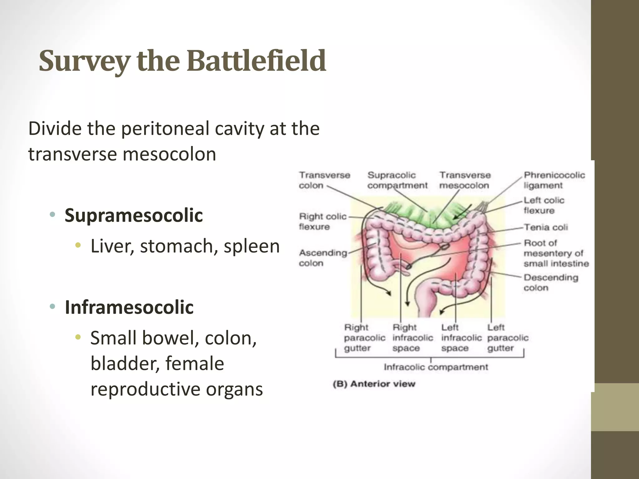 Exploratory laprotomy | PPTX