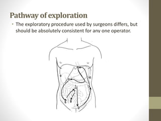 Exploratory laprotomy | PPTX