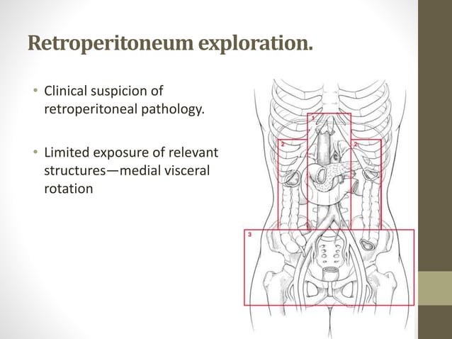 Exploratory laprotomy | PPTX