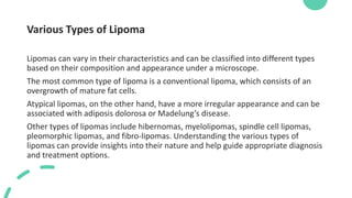 Exploring Lipoma Reasons - Causes, Symptoms, and Treatments.pdf