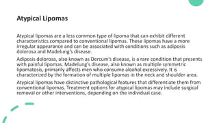 Exploring Lipoma Reasons - Causes, Symptoms, and Treatments.pdf