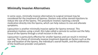 Exploring Lipoma Reasons - Causes, Symptoms, and Treatments.pdf