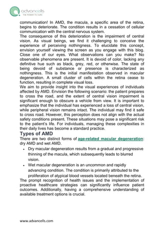 Exploring Stem Cell Therapy for Macular Degeneration in India | PDF
