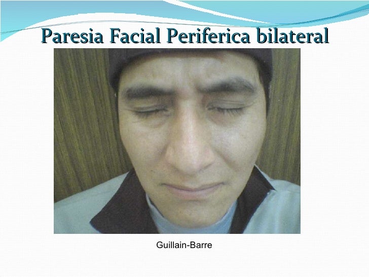 Bloc d´un Metge de Família: Les 3 Tres causes mes freqüents de Paràlisi ...