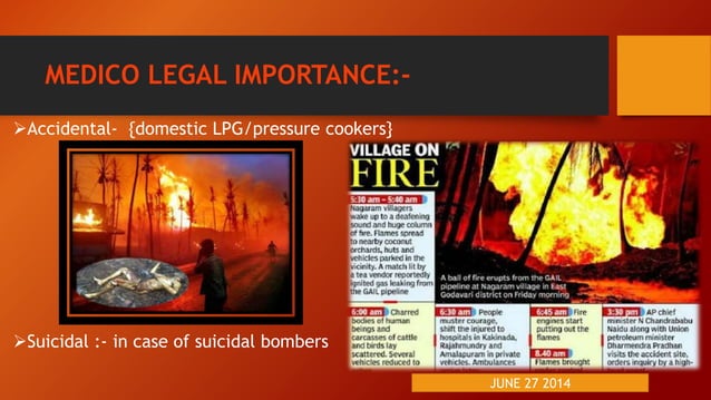 Explosive injuries ppt by himasri reddy | PPT