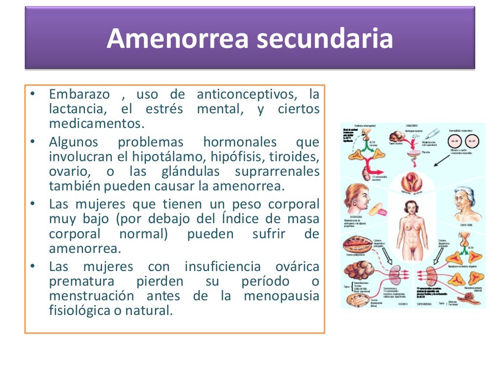 AMENORREA